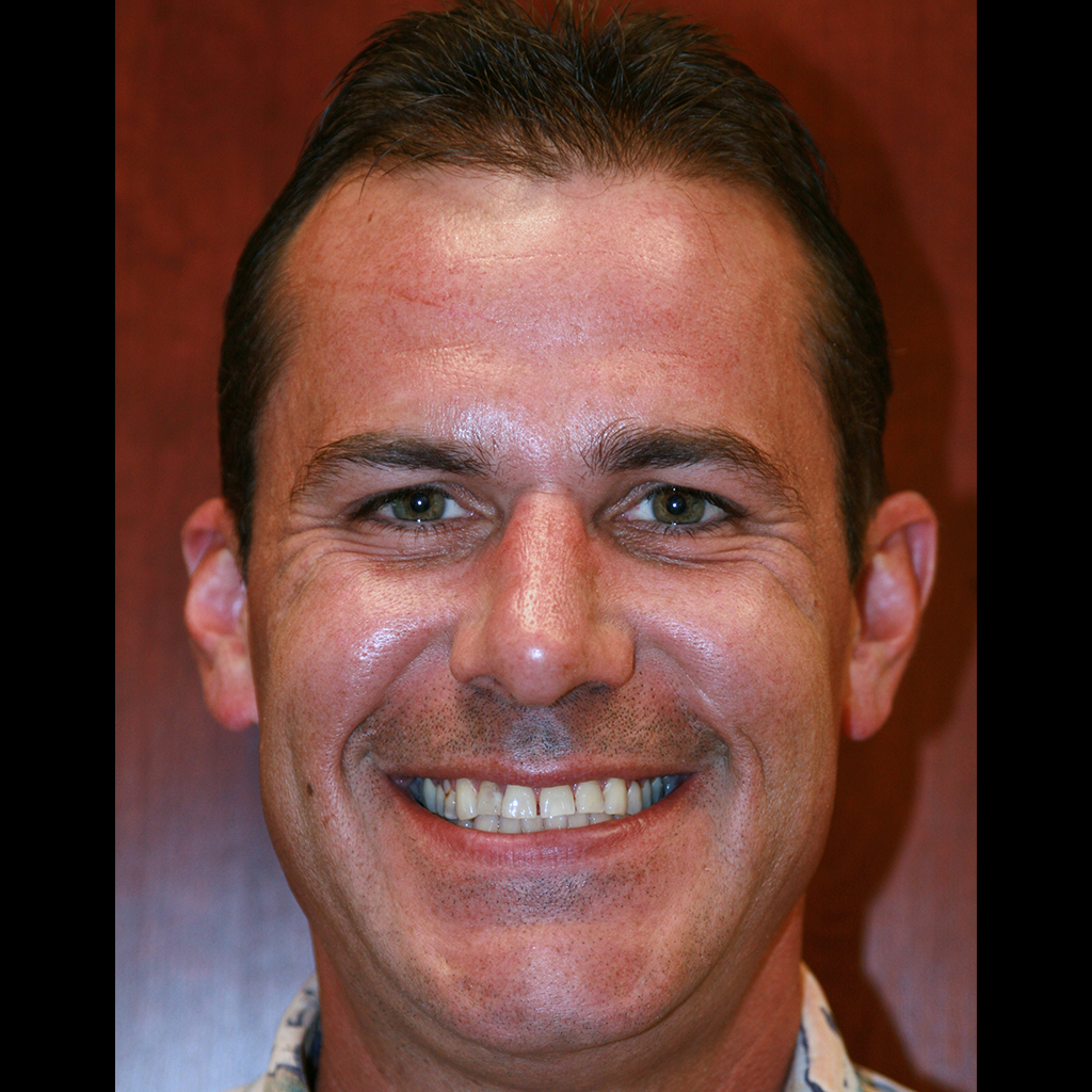 Smile Gallery | Intermountain Smiles | Dentist in Sandy, UT 84070